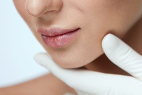 Upper Lip Lift | Visage Plastic Surgery | Female Plastic Surgeon